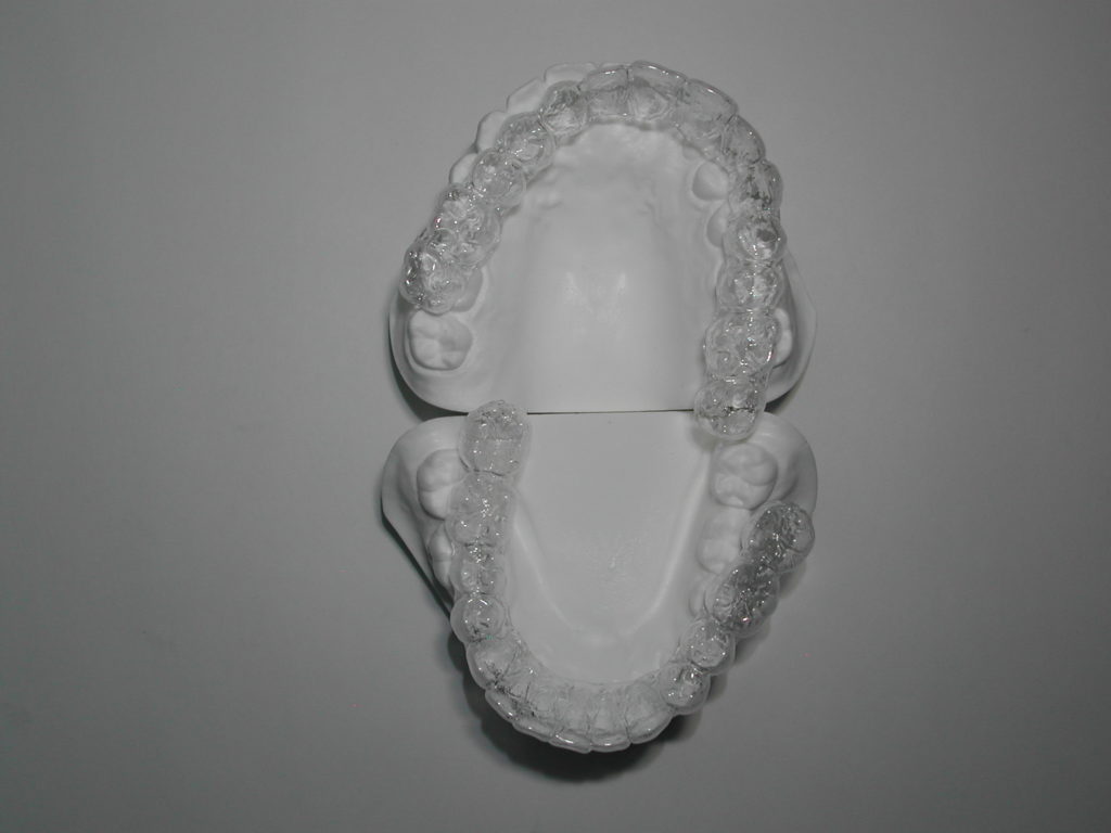 Appliance Instructions in Ashburn, VA | Ashburn Pediatric Dental Center