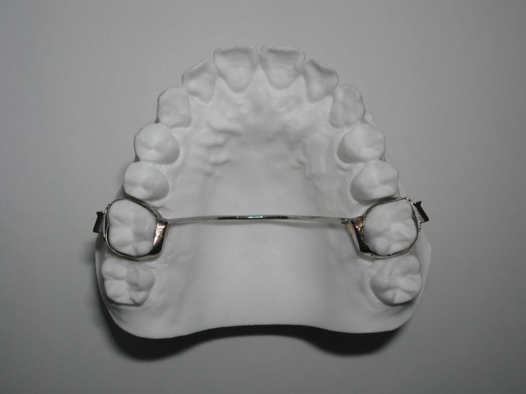 Appliance Instructions in Ashburn, VA | Ashburn Pediatric Dental Center